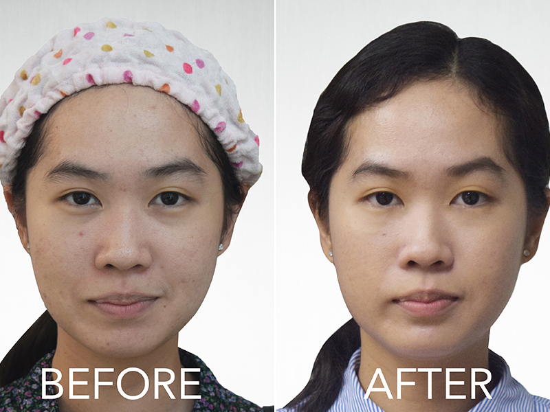 Tighten Loose Skin with Skincare Solutions’ New Kinetic Facelift ...